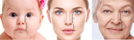 What surprising thing your face loses with aging: Bone | Moy Fincher Chipps