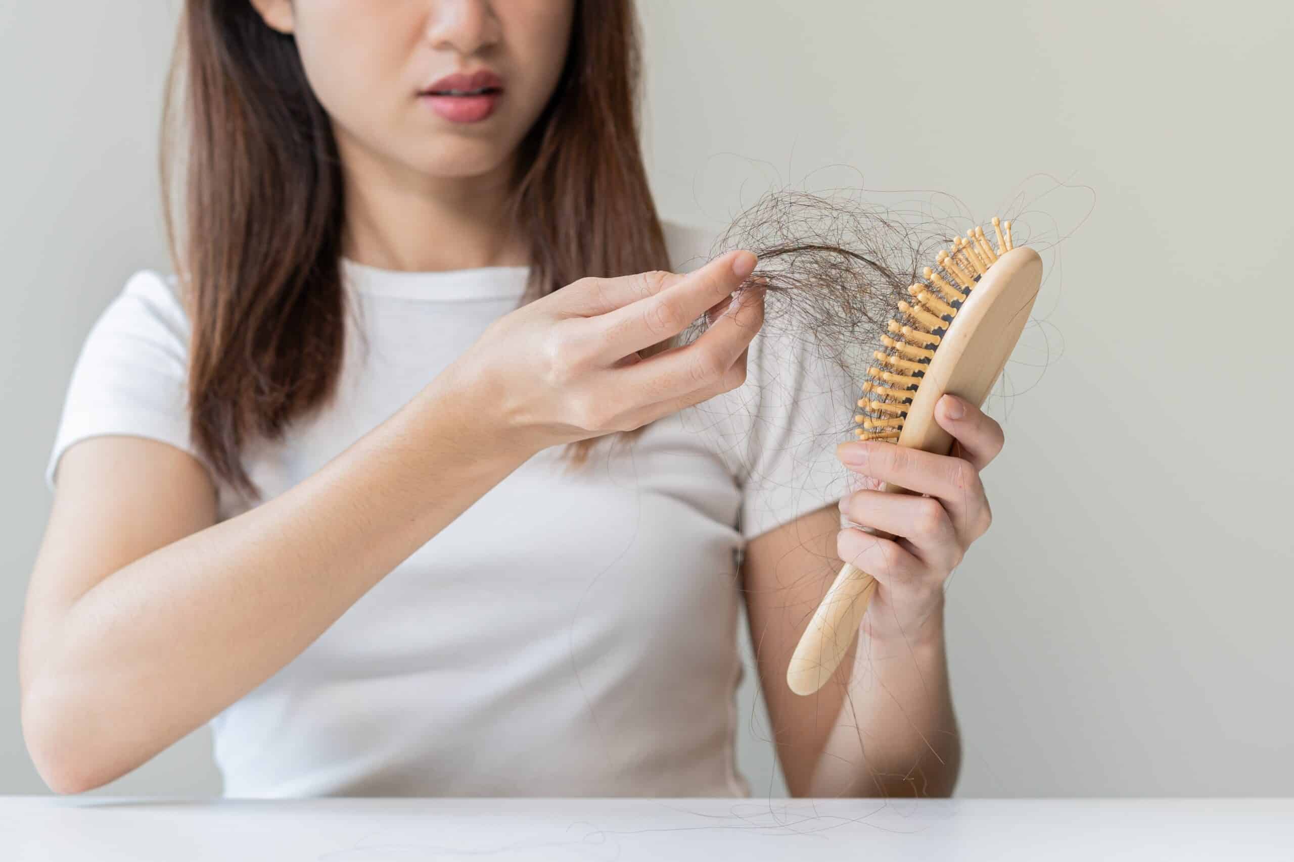 Treating Hair Loss with PRP and Lasers | Moy Fincher Chipps